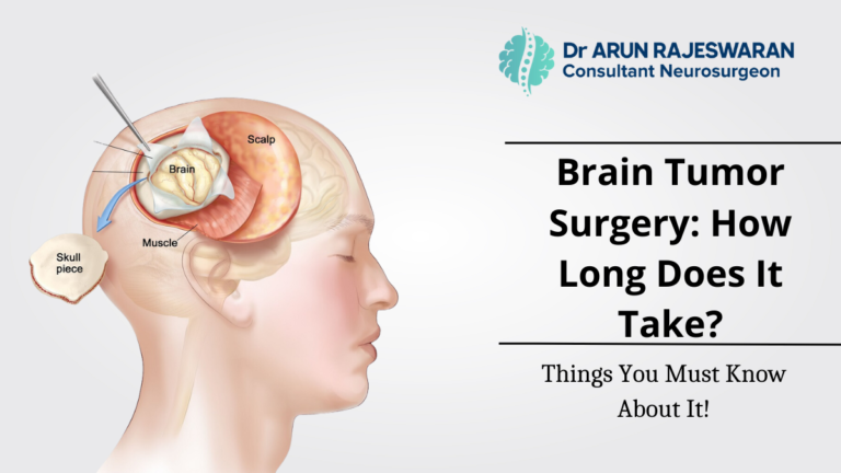 How Long Does Brain Tumor Surgery Take? | What to Expect