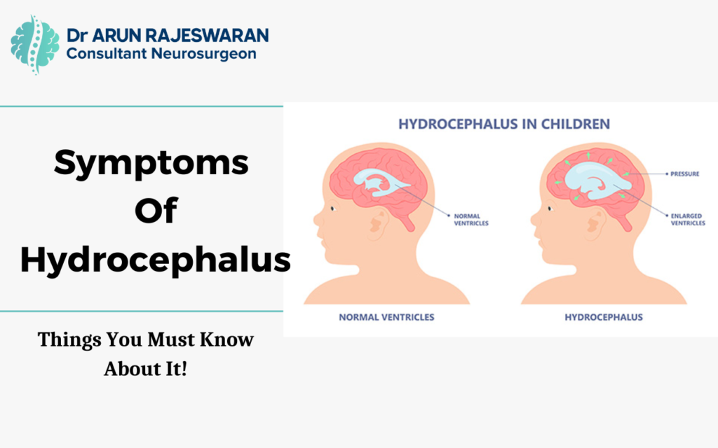 Hydrocephalus Symptoms: What to Watch For | Dr Arun