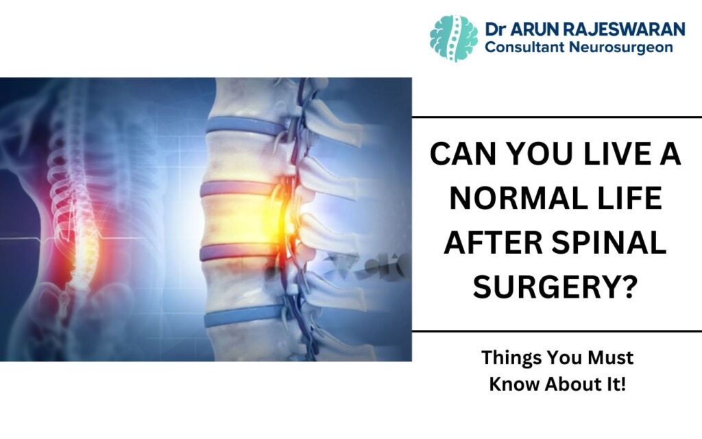 Can You Live a Normal Life After Spinal Surgery? | Expert