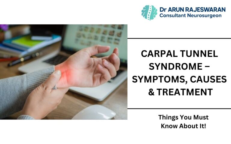 Carpal Tunnel Syndrome – Symptoms, Causes & Treatment